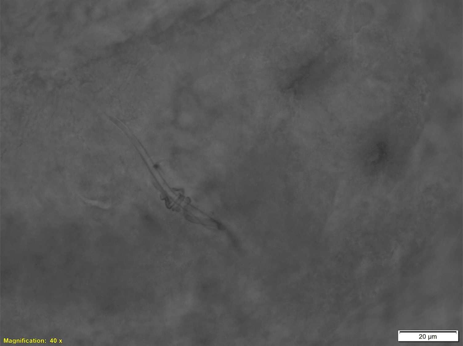 Identifying small invaders: DNA Barcoding Gill Flukes | Bento Lab